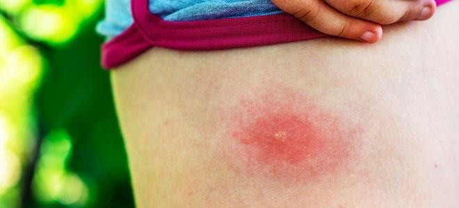 What to Know About Ticks and Winter | DoItYourself.com