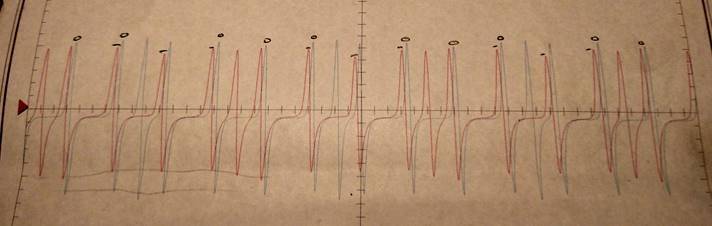 P0344 and P0340 with some helpful information about camshaft position ...